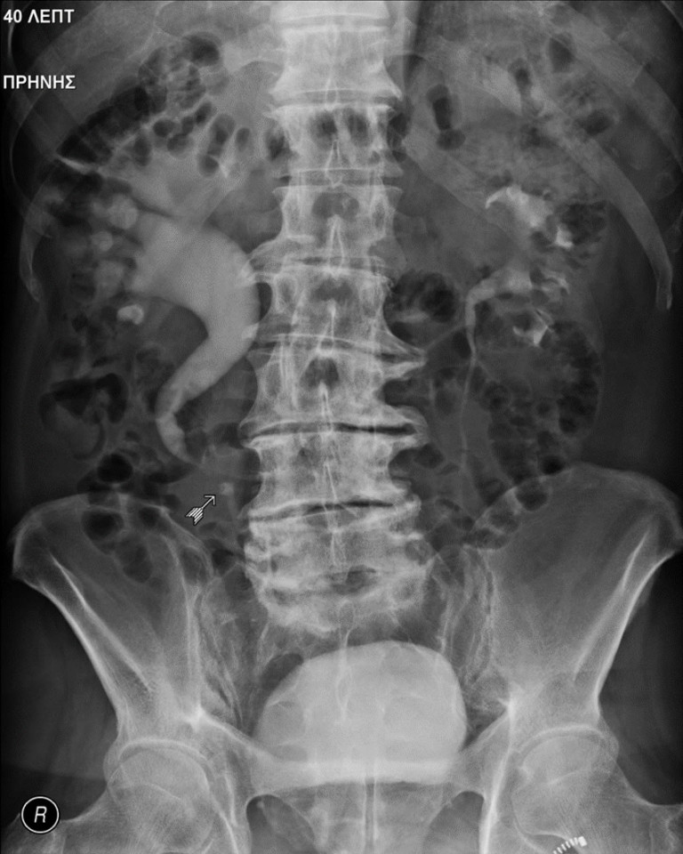 Ψηφιακές Ακτινογραφίες - Ακτινοδιάγνωση Λευκάδας